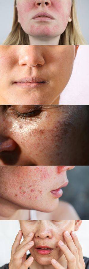 The Ordinary Simplistic Regimen for Beginners